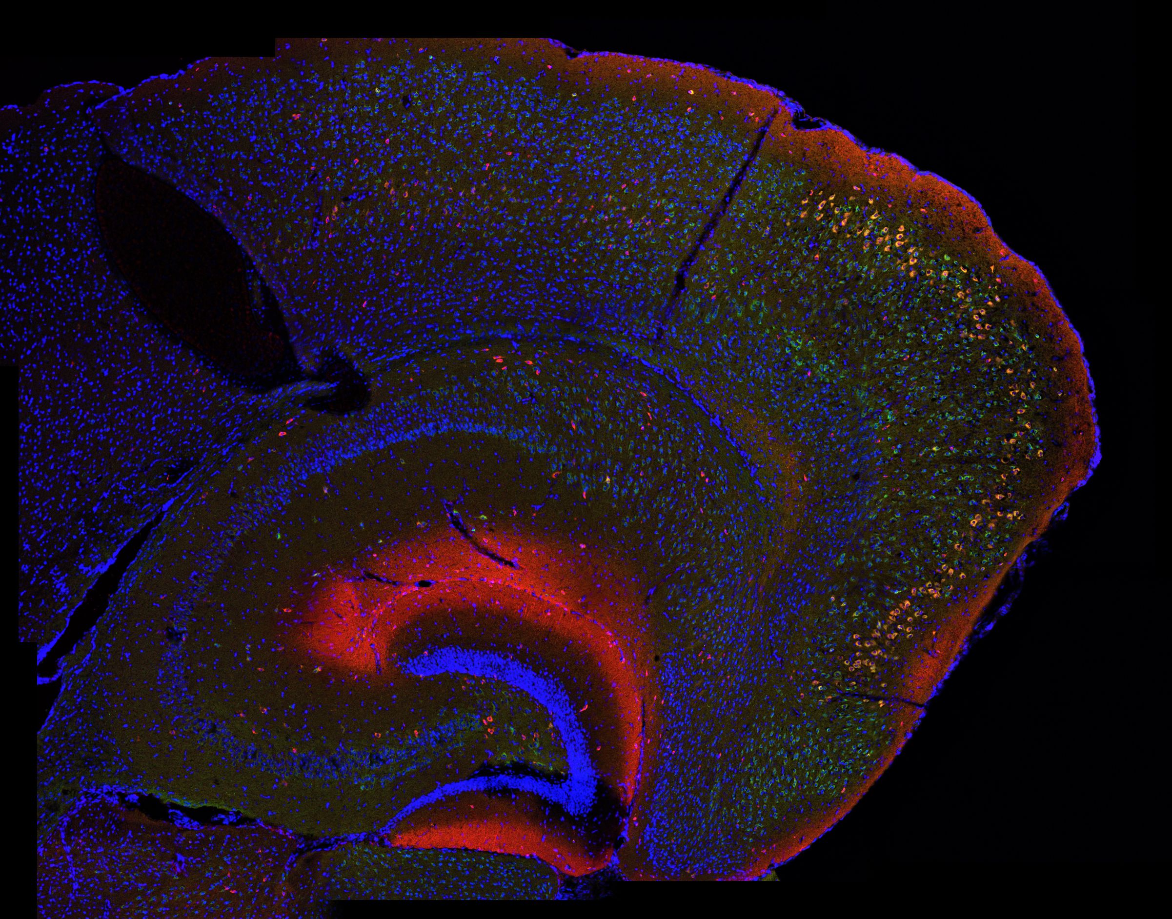Neuroscientists study how neuron network activity is affected in the ...